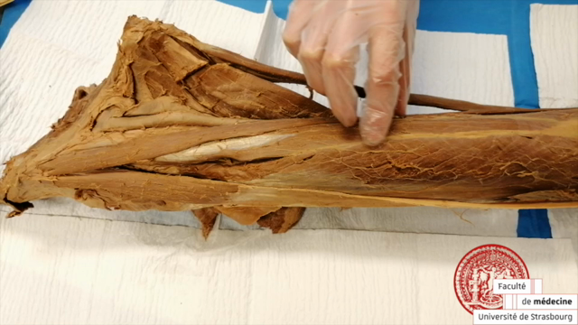 - Tp Anatomie Dfgsm2-Membres-Dissection