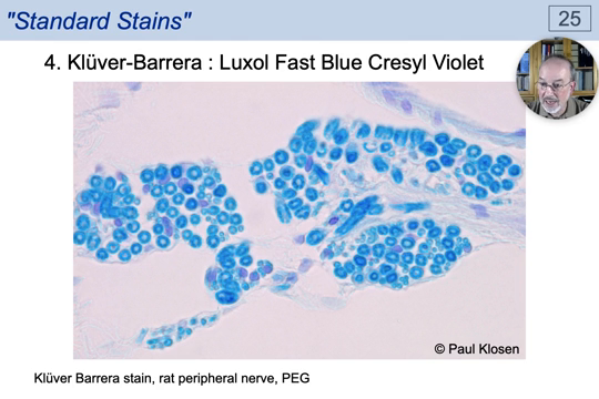 - 04 - Classical Staining Techniques - Myelin