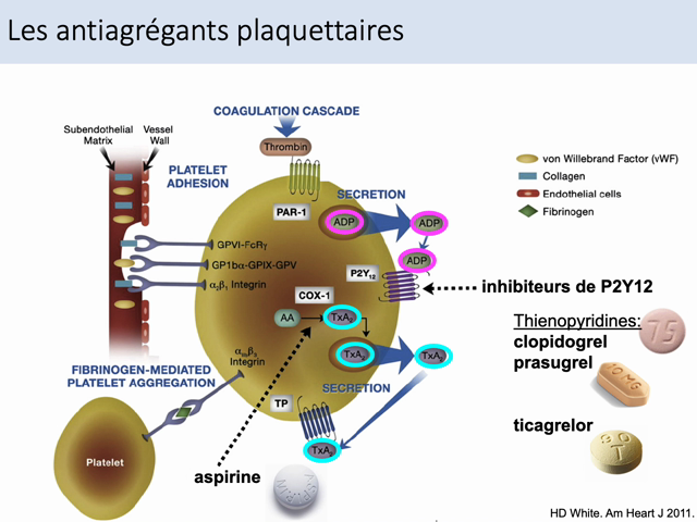 - Dfasm2 E04b Périopératoire Dr Tacquard